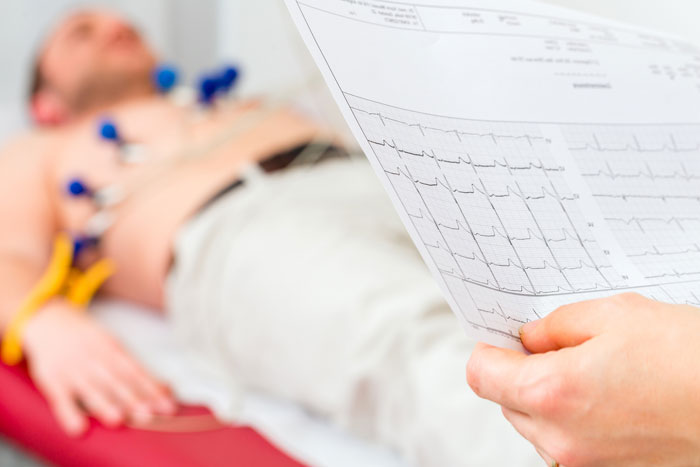 Abnormal ECG: what it means and what to do about it - Evolving World