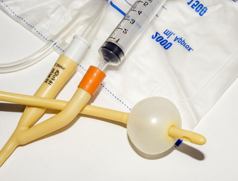 ⚡ Suprapubic catheter: insertion, procedure and complications ...
